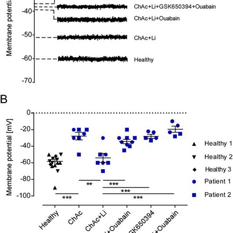 Characterisation Of Ipsc Derived Cortical Neurons Patient Derived