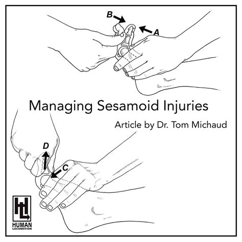 Managing Sesamoid Injuries Human Locomotion