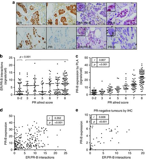 Associations Between Total PR Expression ER PR B Interactions And PR B Download Scientific