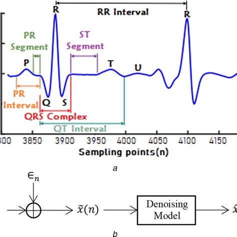 PDF Review Of Noise Removal Techniques In ECG Signals