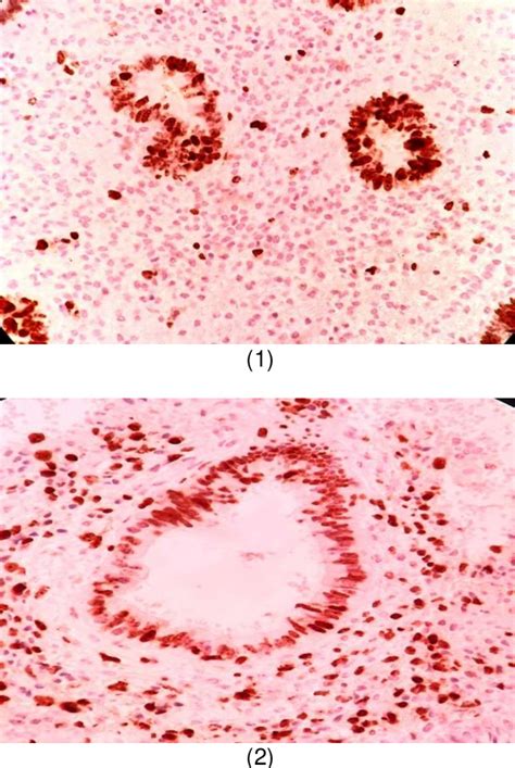figure 1 from clarification of ki67 expression in association with the