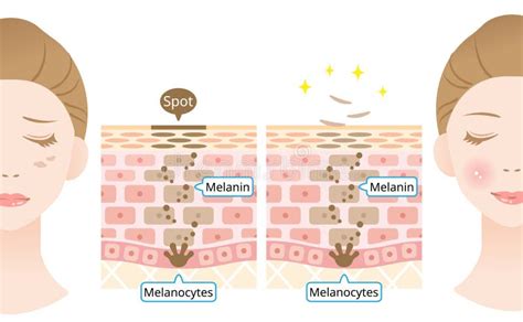 Infographic Illustration Of Difference Between UVA And UVB Rays UV Penetration Into Human Skin