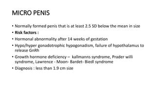 Abnormalities Of External Genital Tract Pptx