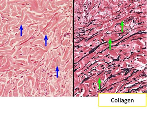 세포외기질 Extracellular Matrix Ecm 의학당