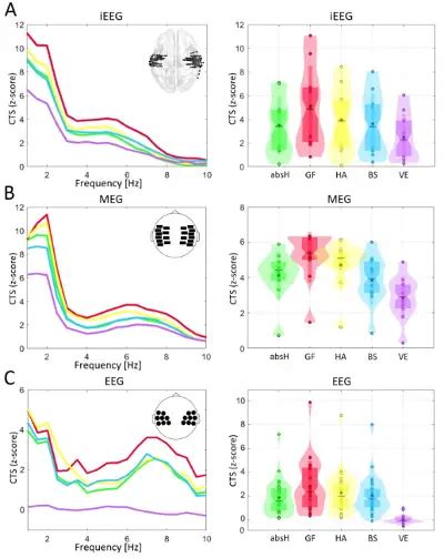 On The Speech Envelope In The Cortical Tracking Of Speech Neurociencias Eeg Erp Eeg Fmri Nirs