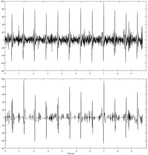 Comparison Between The Output After The Hilbert Transform Stage And The Download Scientific