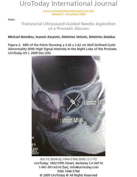 cpt code incision and drainage abscess at olivia brewster blog