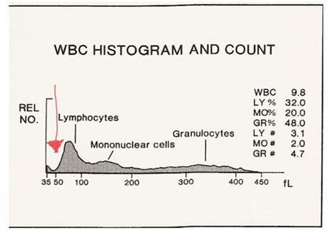 Hematology Lecture 12 Automated Cell Counts And Leukocyte