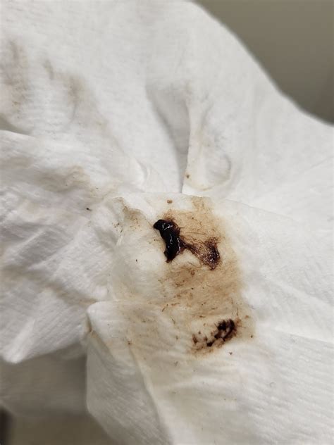 I Bleed During My Ovulation R Period