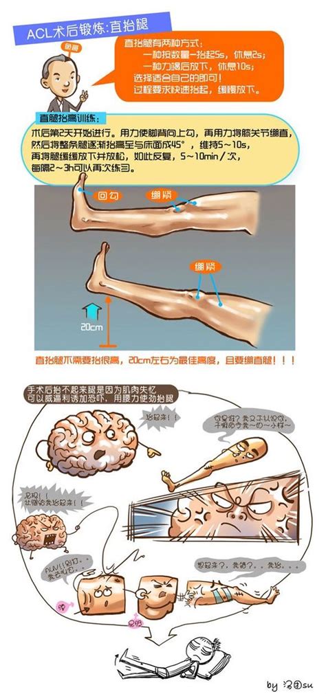 10张图片让你了解acl重建前交叉韧带重建的术后康复 前叉之家