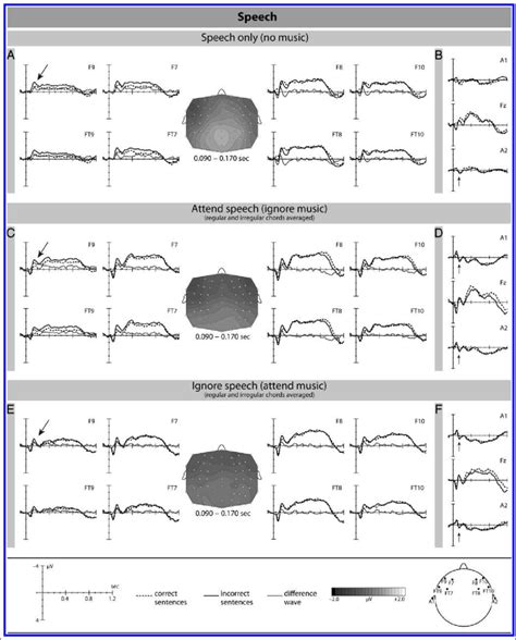 Grand Average Erps And Scalp Distributions Elicited By The Incorrect