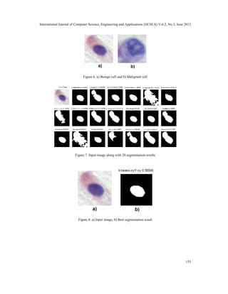SEGMENTATION OF LUNG GLANDULAR CELLS USING MULTIPLE COLOR SPACES PDF