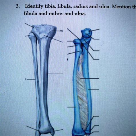 Solved What Difference Between Structure Of Radius Ulna And Fibula