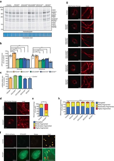 Organelle Knockout Cell Lines Differentially Affect Mitochondrial