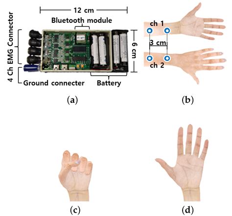 Event Detection Of Muscle Activation Using An Electromyogram