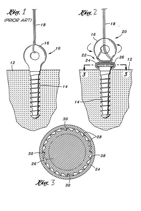 Ligament Structure Patented Technology Retrieval Search Results