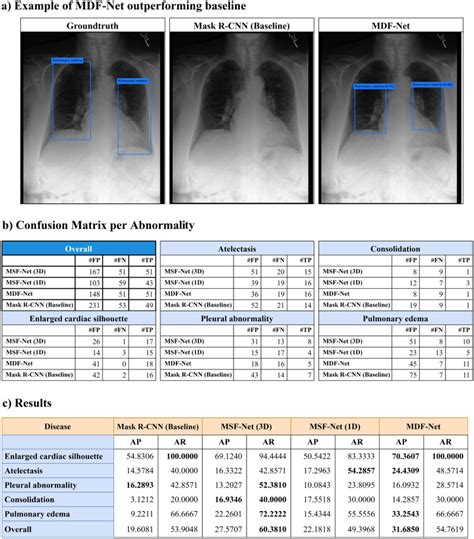 Mdf Net For Abnormality Detection By Fusing X Rays With Clinical Data Pmc