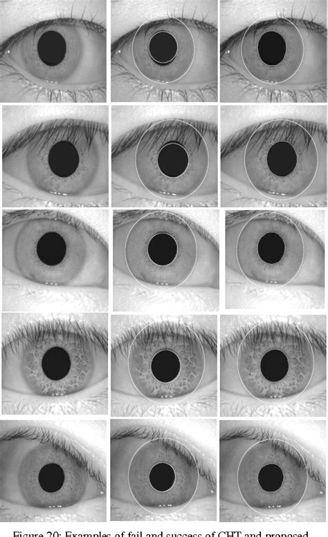 Figure 20 From Iris Detection And Normalization In Image Domain Based On Morphological Features