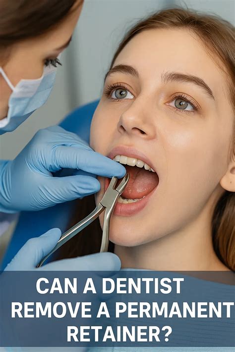 Can A Dentist Remove A Permanent Retainer Everything You Need To Know 🦷