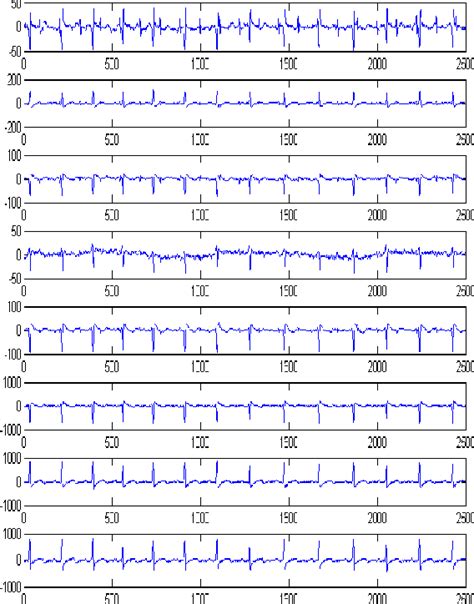 Figure 1 From Extraction Of Fecg Based On Time Frequency Blind Source