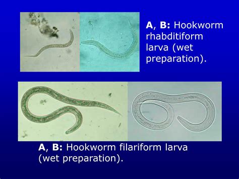 Ppt Hookworms Powerpoint Presentation Free Download Id 3766939