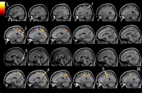 differences in task based neural activity at decision points between