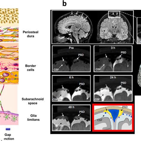 Interstitial Fluid Isf Cerebrospinal Fluid Csf Space Connection Download Scientific