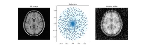 Simple Unet Model — Mri Nufft Documentation