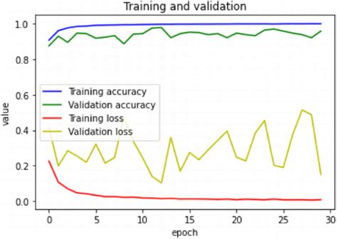 Improvement Of Inceptionv3 Model Classification Performance Using Chest X Ray Images Journal
