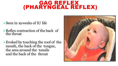 Newborn Reflexes Primitive Reflexes Pptx