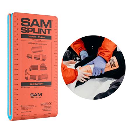 Sam® Splint Alert Services