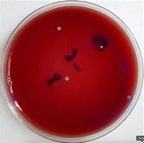 Faster R Cnn Over Detecting Data Pytorch Forums