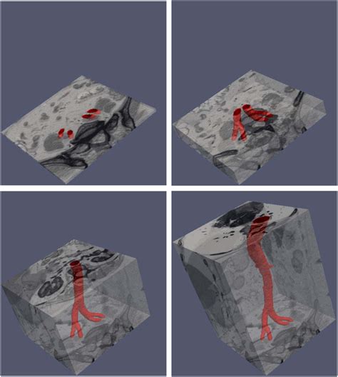 Three Dimensional Representation Of The Segmentation Of Fig 6 Which Download Scientific