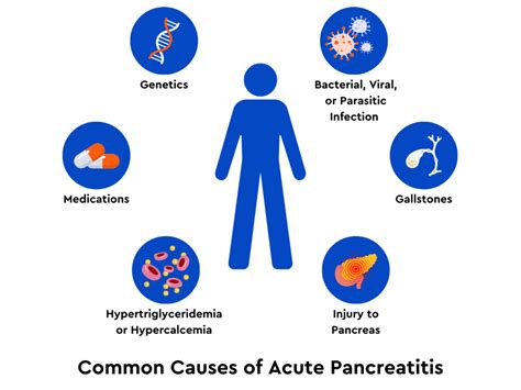 Acute Pancreatitis Missioncure