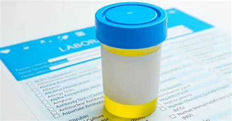 Urine Test For Uti An Essential Diagnostic Tool For Urinary Tract Health