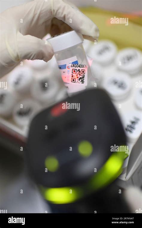 A Worker Prepares Samples For Artificial Intelligence Assisted Cytology Testing For Cervical