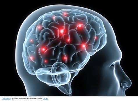 Memory Failure Types And Human Error Human Error Solutions GMP Training By Ginette Collazo