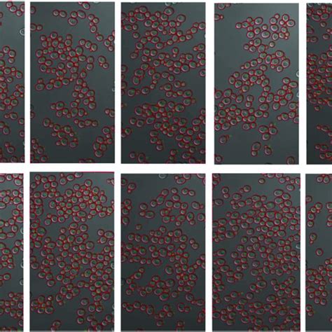 Example Of Yeast Cells Segmentation First Column Raw Dic Image