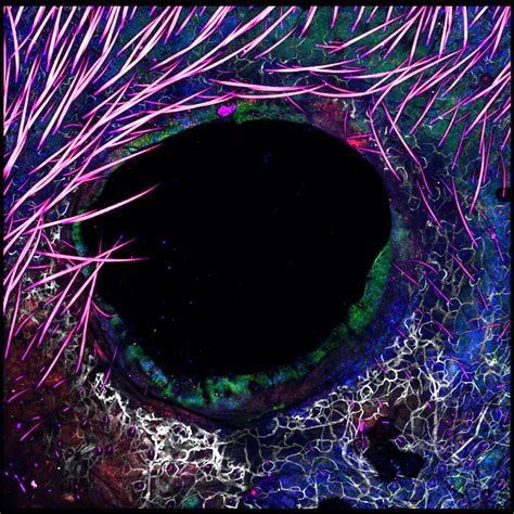Deciphering The Signals Between Invaders And Immune Cells Immunology