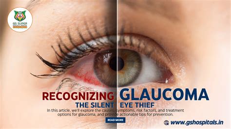 Closed Angle Glaucoma Vision