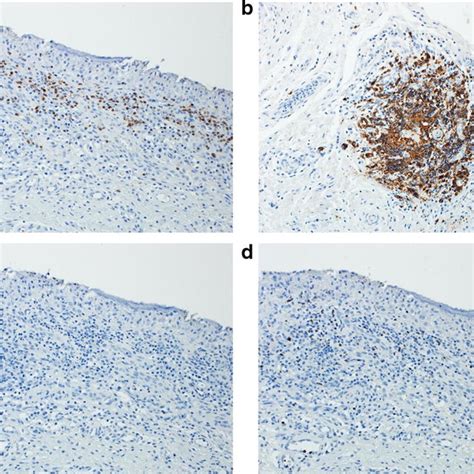 Relationship Between The Number Of Cd3 Positive T Cells And The Number