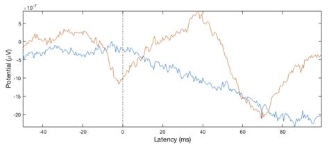 Eeglab And Ieeg Data Eeglab Wiki