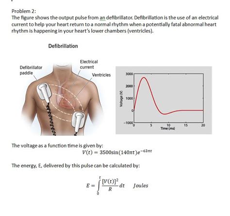 Problem 2the Figure Shows The Output Pulse From An
