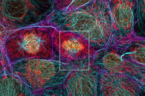 How Lsm 980 Can Image Cos 7 Cells In Nir Ania Botha Henning Posted