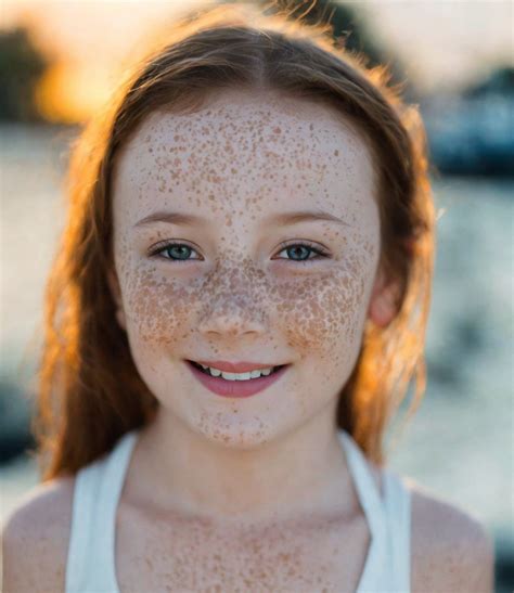 Freckles Perfect Freckles Freckles Are Beautiful A Lot Of Freckles