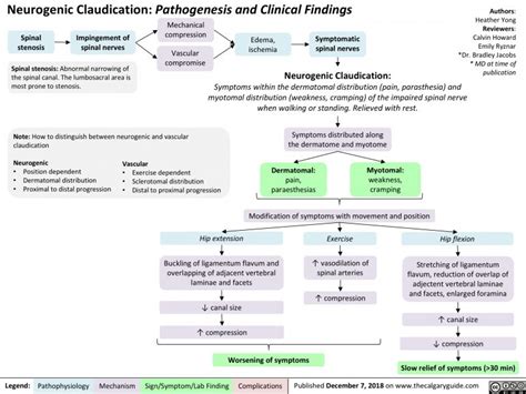 Neurogenic Claudication Pathogenesis And Clinical Findings Calgary Guide