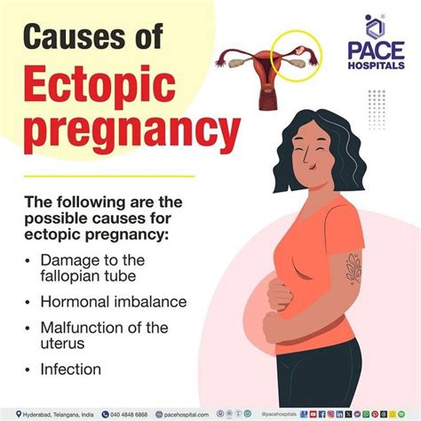 Ectopic Pregnancy Causes Causes Of Ectopic Pregnancy Medizzy