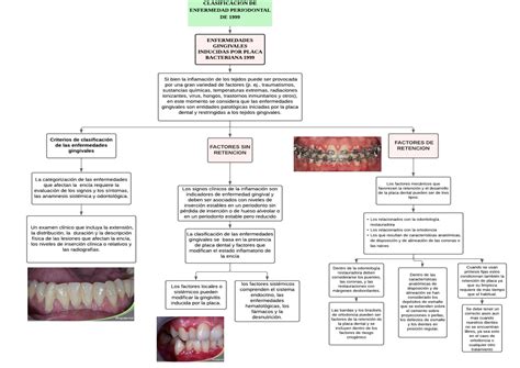 Solution 1999 Classification Of Periodontal Disease Studypool