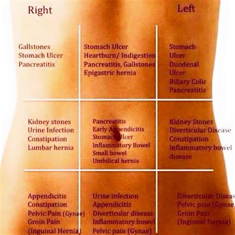 Abdominal Pain Diagnosis Chart Nhs Kdgjx