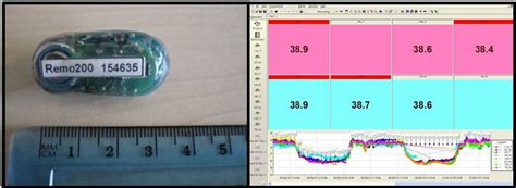 Telemetry System Temperature Implants Remo Technologies Left Are